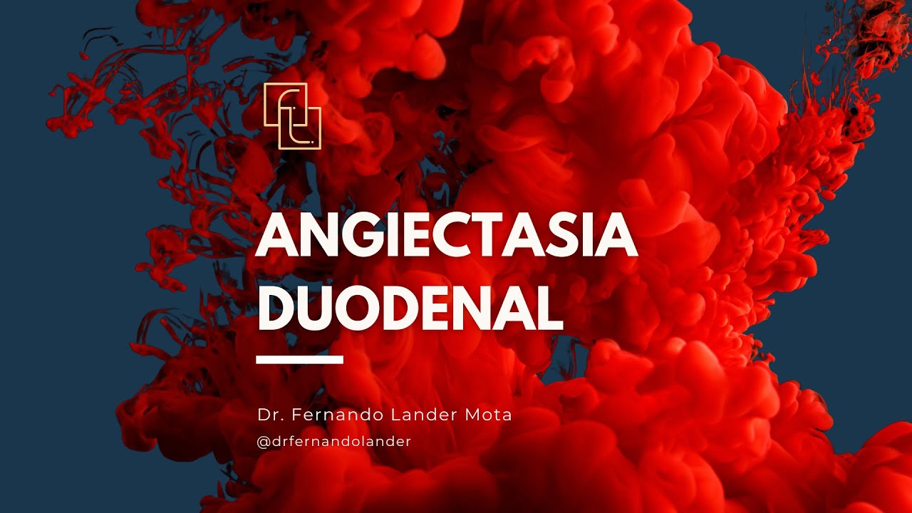 ANGIECTASIA DUODENAL - YouTube
