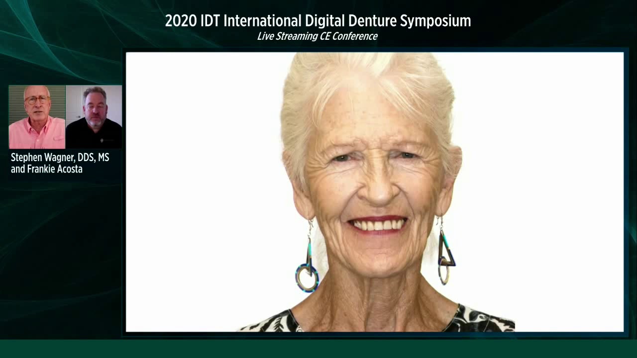 Intraoral Edentulous Scanning–Accurate, Faster, Easier, with ...