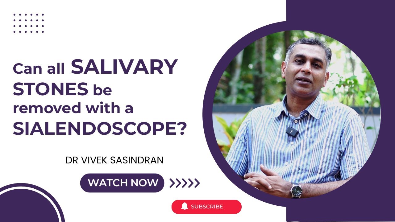 Salivary Calculi | Salivary Gland Stones | Sialoendoscopy Retrieval ...