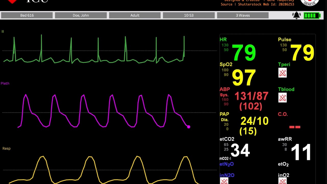 Tableau ICU (EKG) Monitor Dashboard - YouTube