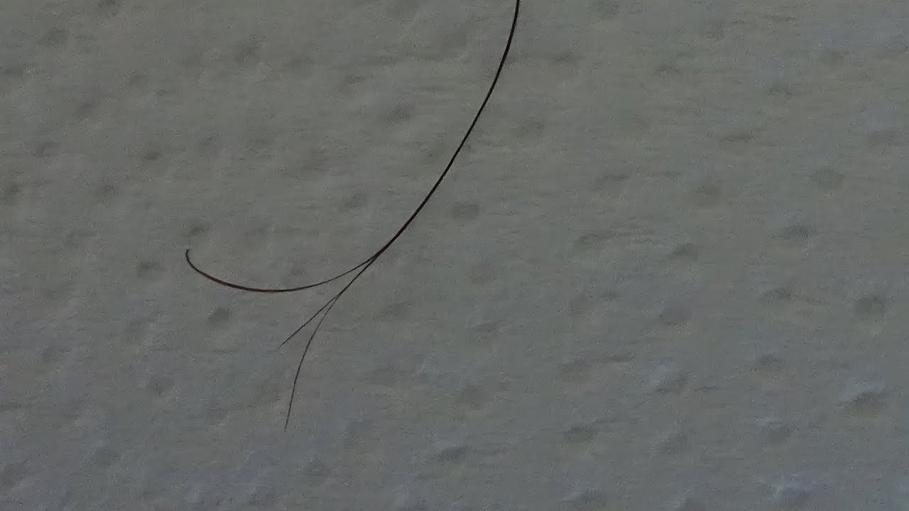 ¿Orzuela en el bigote? - YouTube