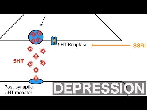 Major Depression and SSRI's/SNRI's