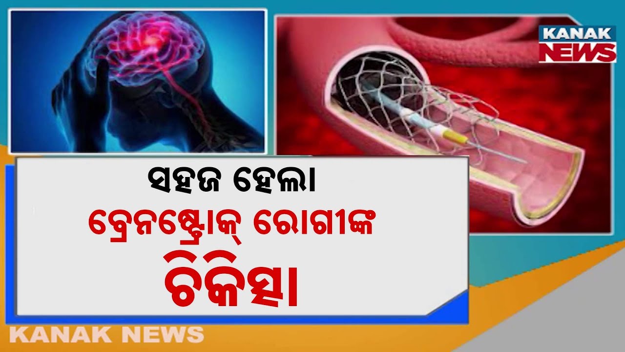 Indian Scientists Invent 'Supernova Stent Retriever' for Easier Brain ...