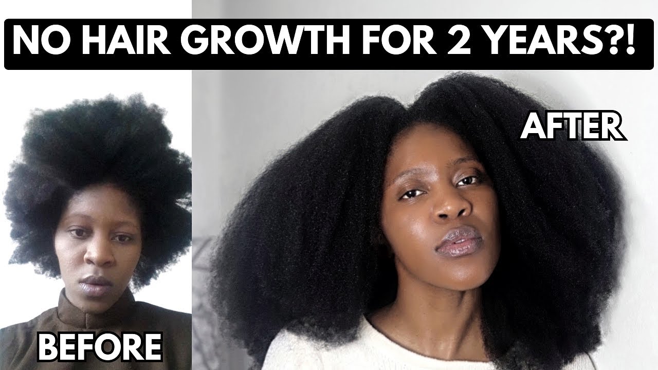 How to get UNSTUCK on your HAIR GROWTH JOURNEY | Natural Hair | South African Journey - YouTube