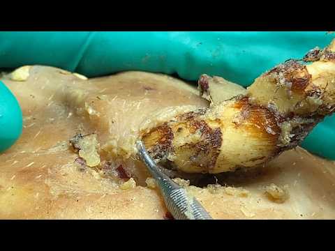 𝑺𝒂𝒕𝒊𝒔𝒇𝒚𝒊𝒏𝒈 𝑭𝒂𝒄𝒊𝒂𝒍 𝑪𝒍𝒆𝒂𝒏𝒔𝒊𝒏𝒈: 𝑴𝒊𝒄𝒆𝒍𝒍𝒂𝒓 𝑾𝒂𝒕𝒆𝒓 𝒗𝒔 𝑪𝒍𝒆𝒂𝒏𝒔𝒊𝒏𝒈 𝑶𝒊𝒍 0948