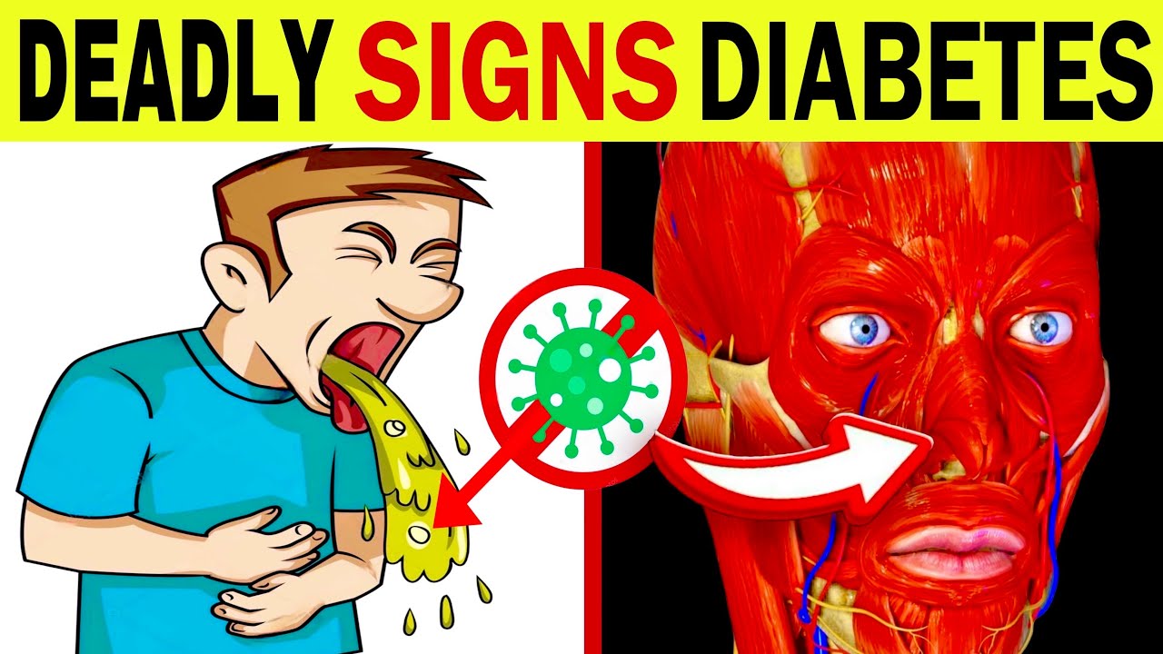 7 Deadly Signs Of Diabetes You Cant Ignore Diabetic Ketoacidosis Youtube