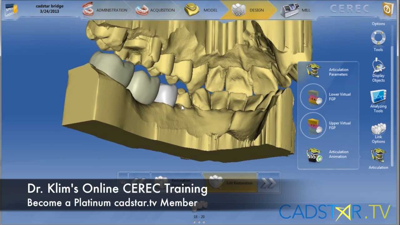 CEREC 4.2 Design Tools - YouTube