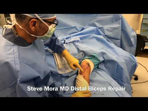 Distal Biceps Tendon Repair Using a Toggle Bolt Technique-Dr Mora - YouTube