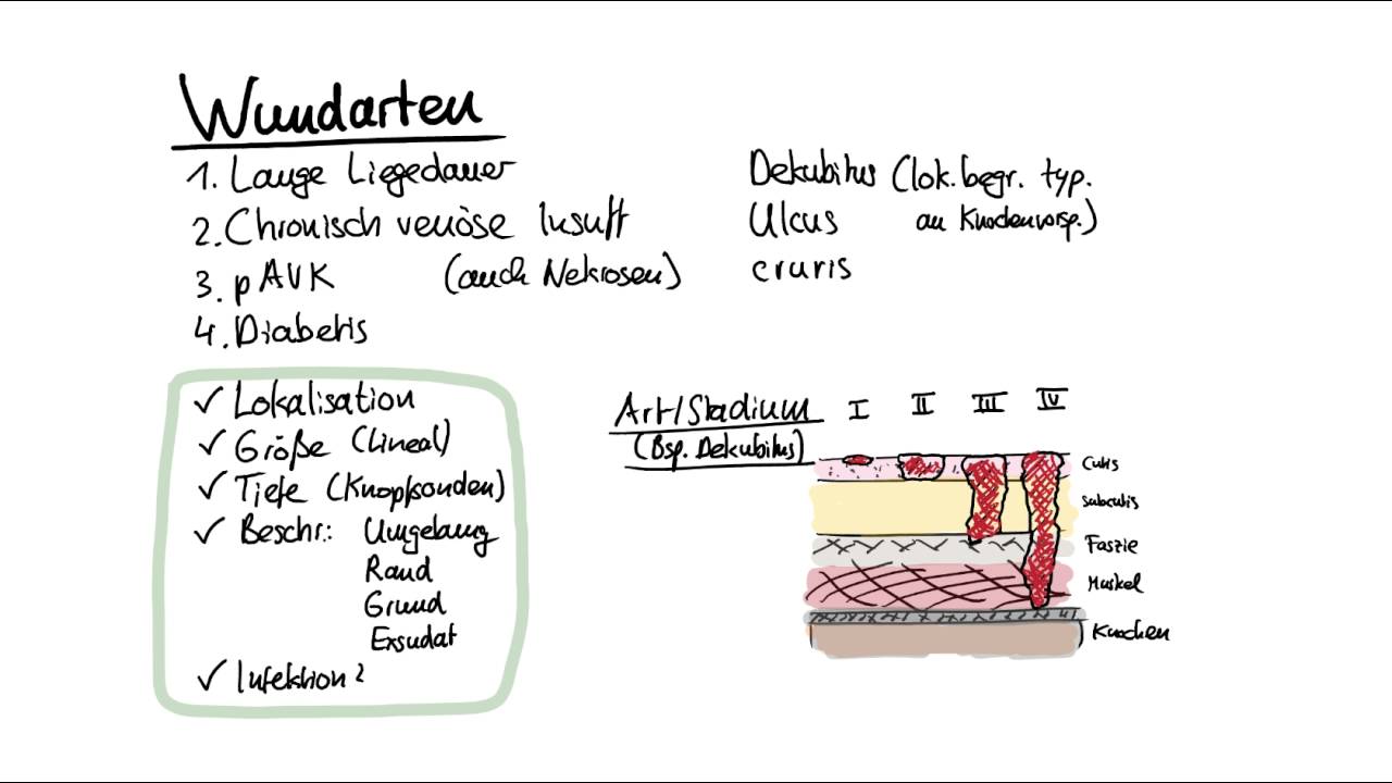 M36W2 S2 #2 Wundarten und Wundbefund - YouTube
