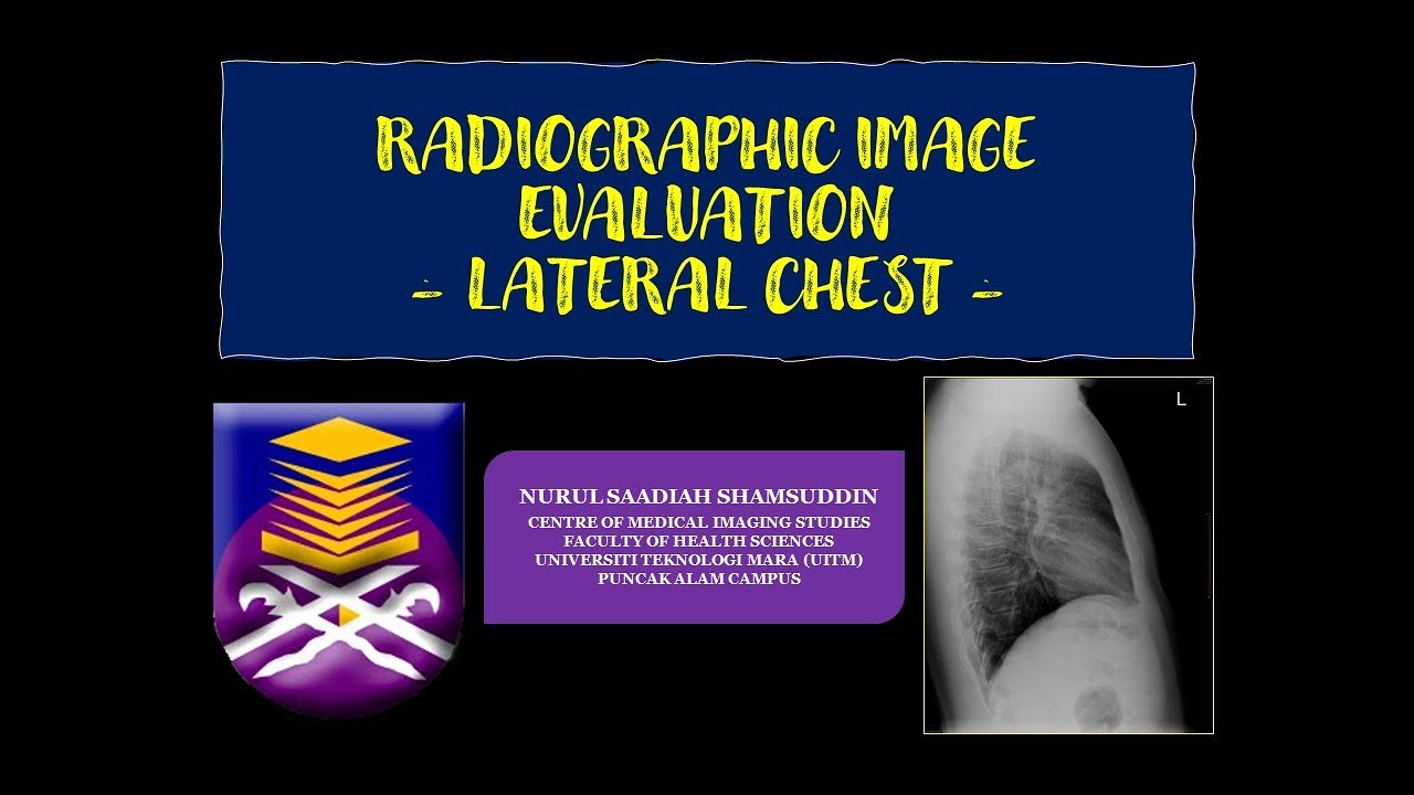 Radiographic Image Evaluation of Chest in Lateral Projection - YouTube