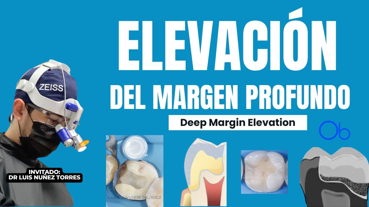 Elevación de margen profundo 🦷 con Dr Luis Javier Nuñez Torres - YouTube