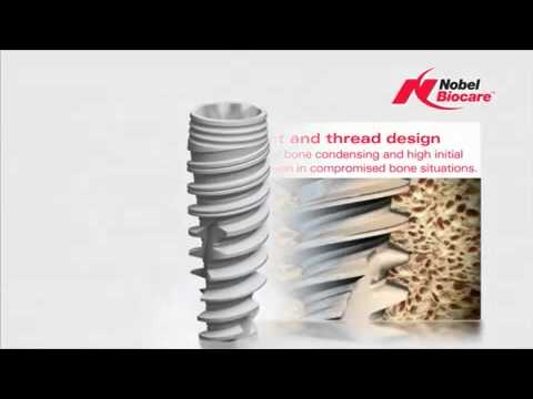 Nobel Active Nobel Biocare implante dental.mp4 - YouTube