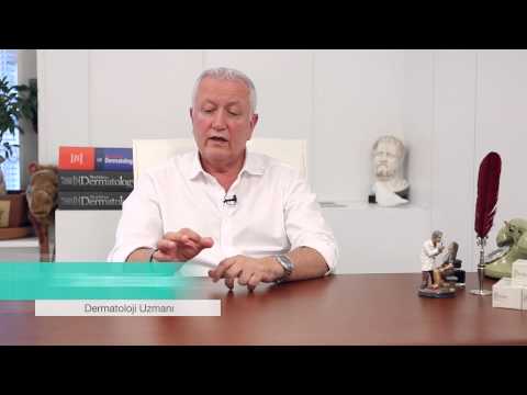 Saç kıran ve tedavisi