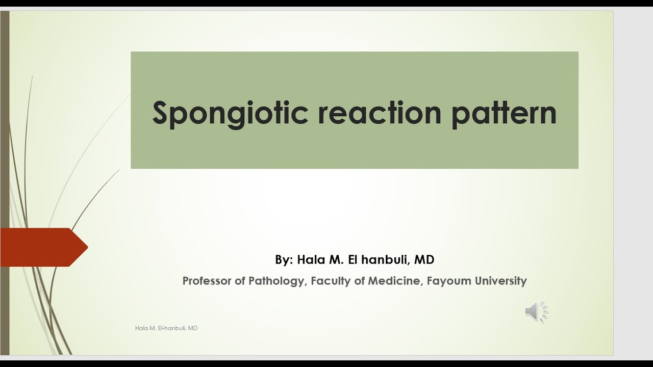Spongiotic Reaction - YouTube