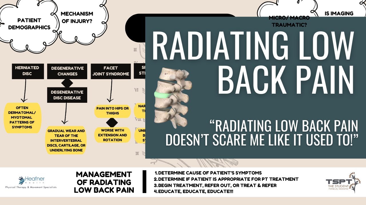 Radiating Low Back Pain - YouTube