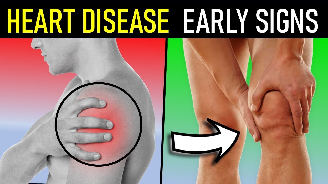 DONT IGNORE The 12 EARLY Warning Signs Of Heart Disease Your Body Shows ...