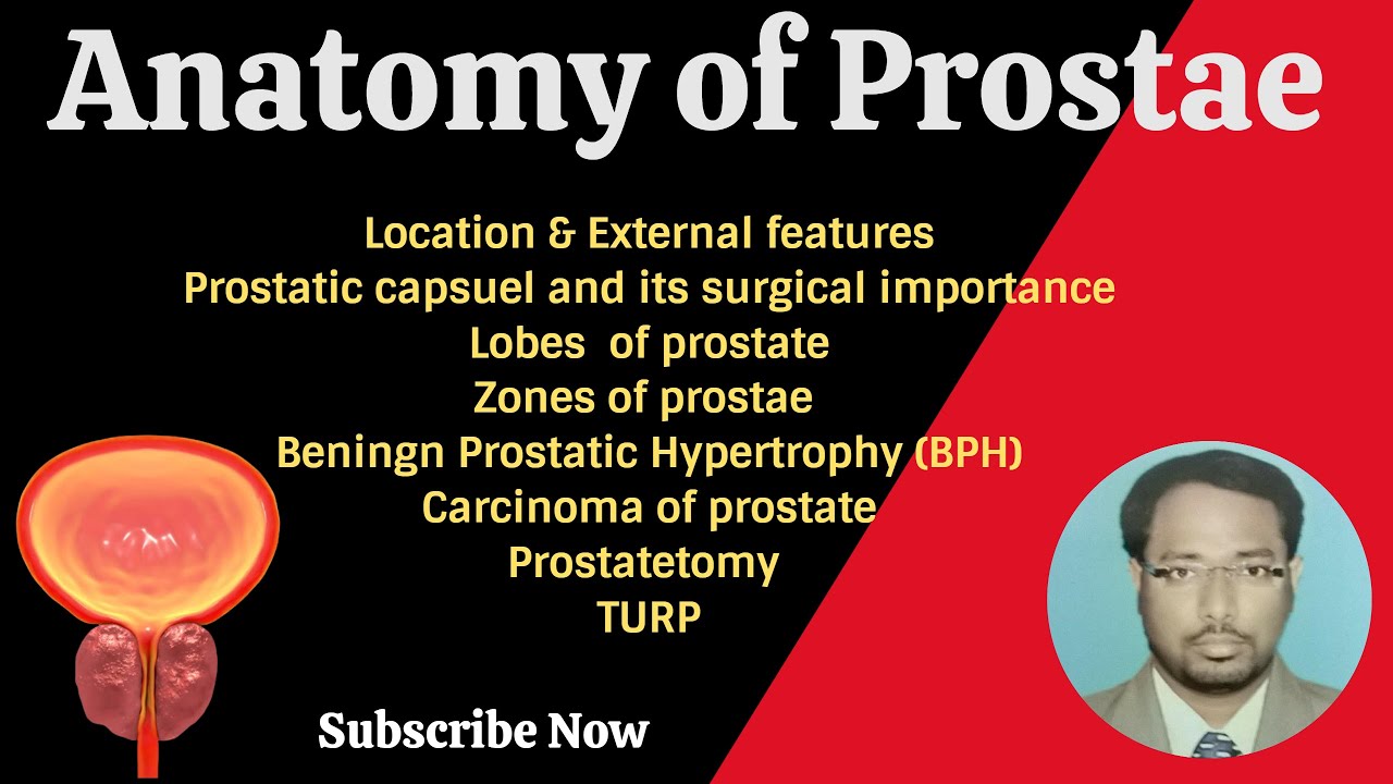 ANATOMY OF PROSTATE- LOCATION/ EXTERNAL FEATURES/ LOBES/ ZONES/ APPLIED ...