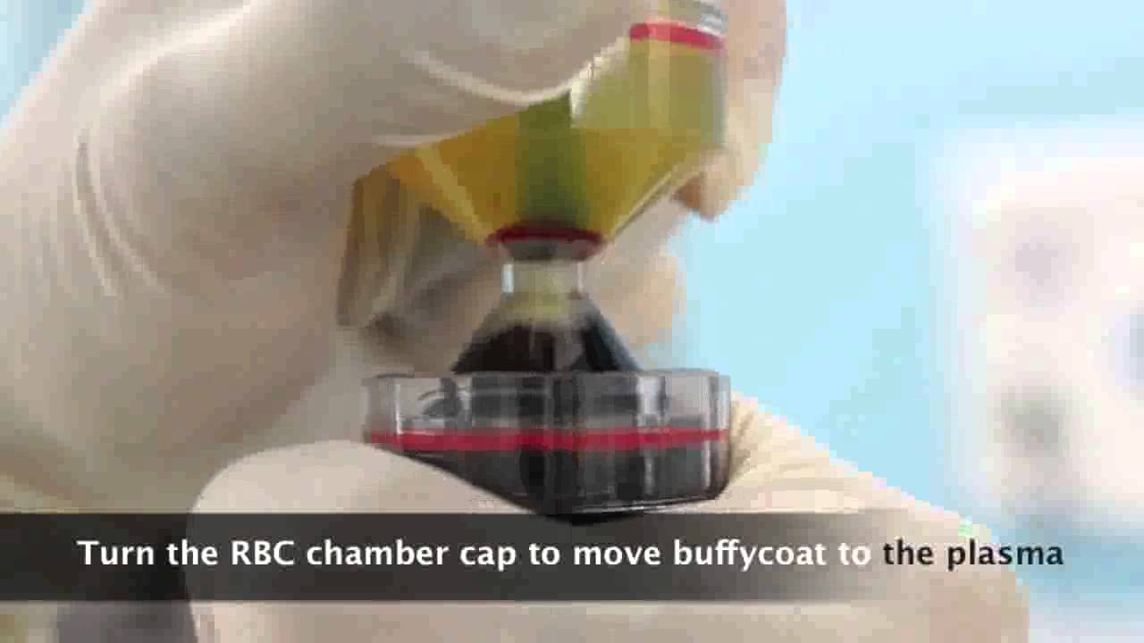 PRP kit What is TriCeLL - YouTube