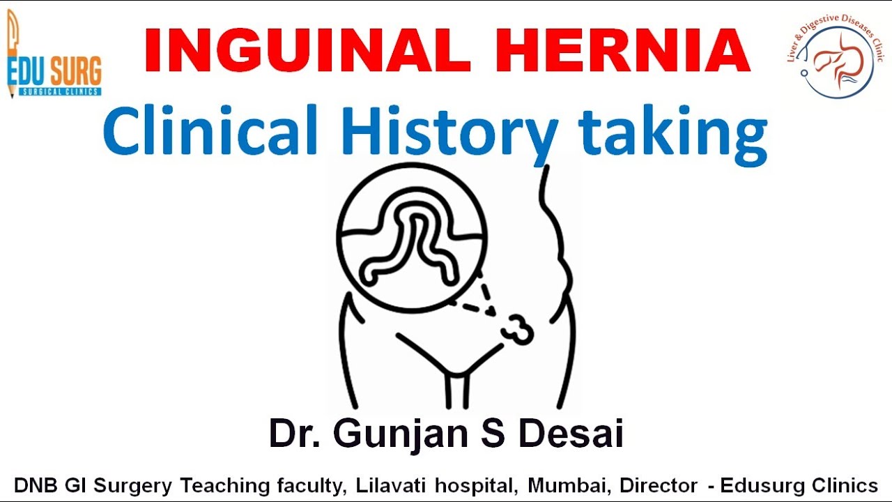 Clinical Approach to Inguinal Hernia | History Taking & Differential ...