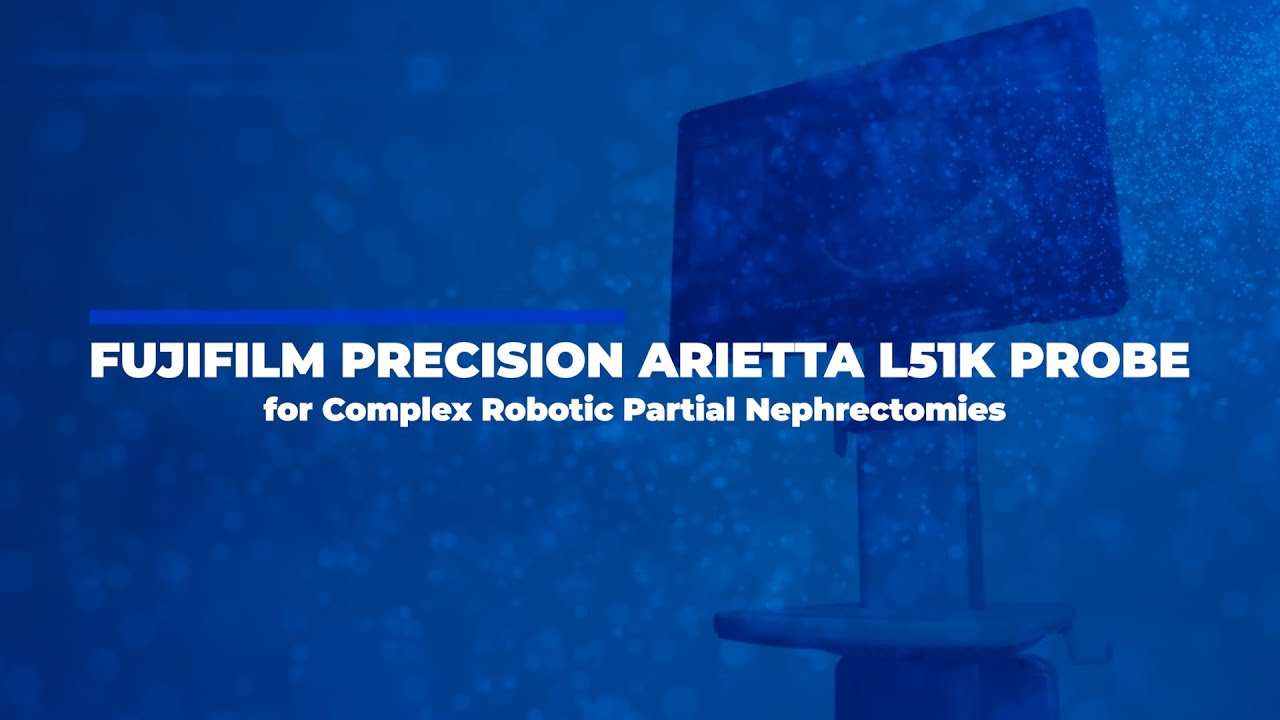 Fujifilm Precision Arietta L51K Probe for Complex Robotic Partial ...