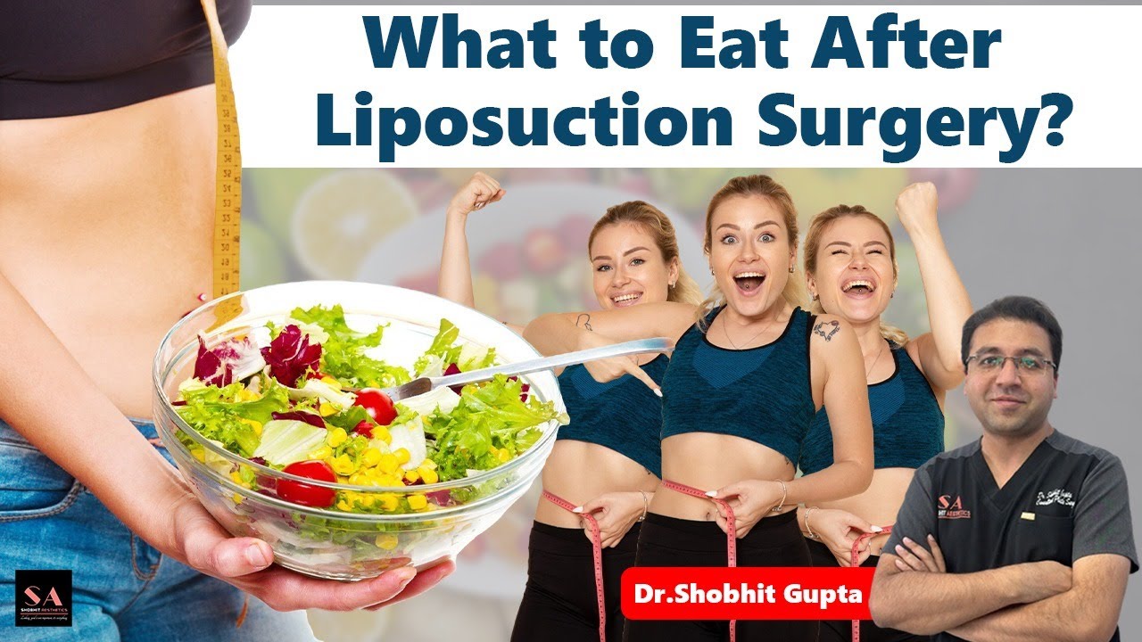What to Eat After Liposuction Surgery? | After Liposuction 🥗 Diet Plan ...
