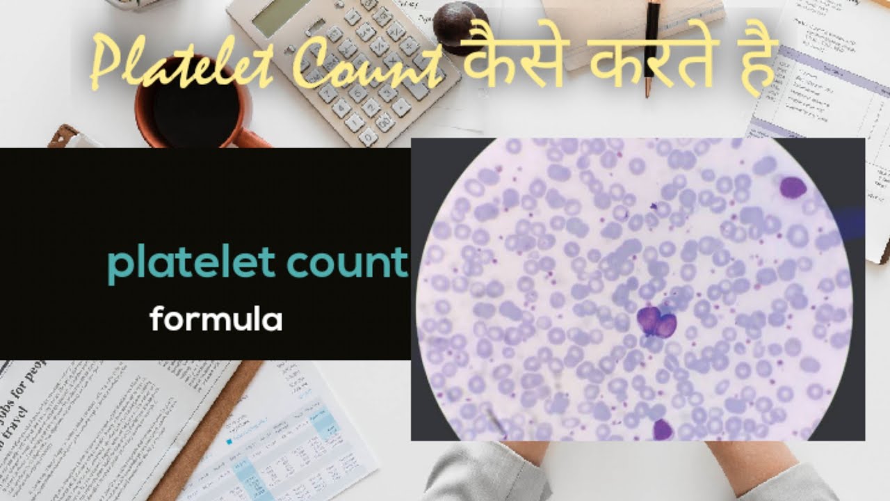 platelet count formula | medical laboratory technician - YouTube