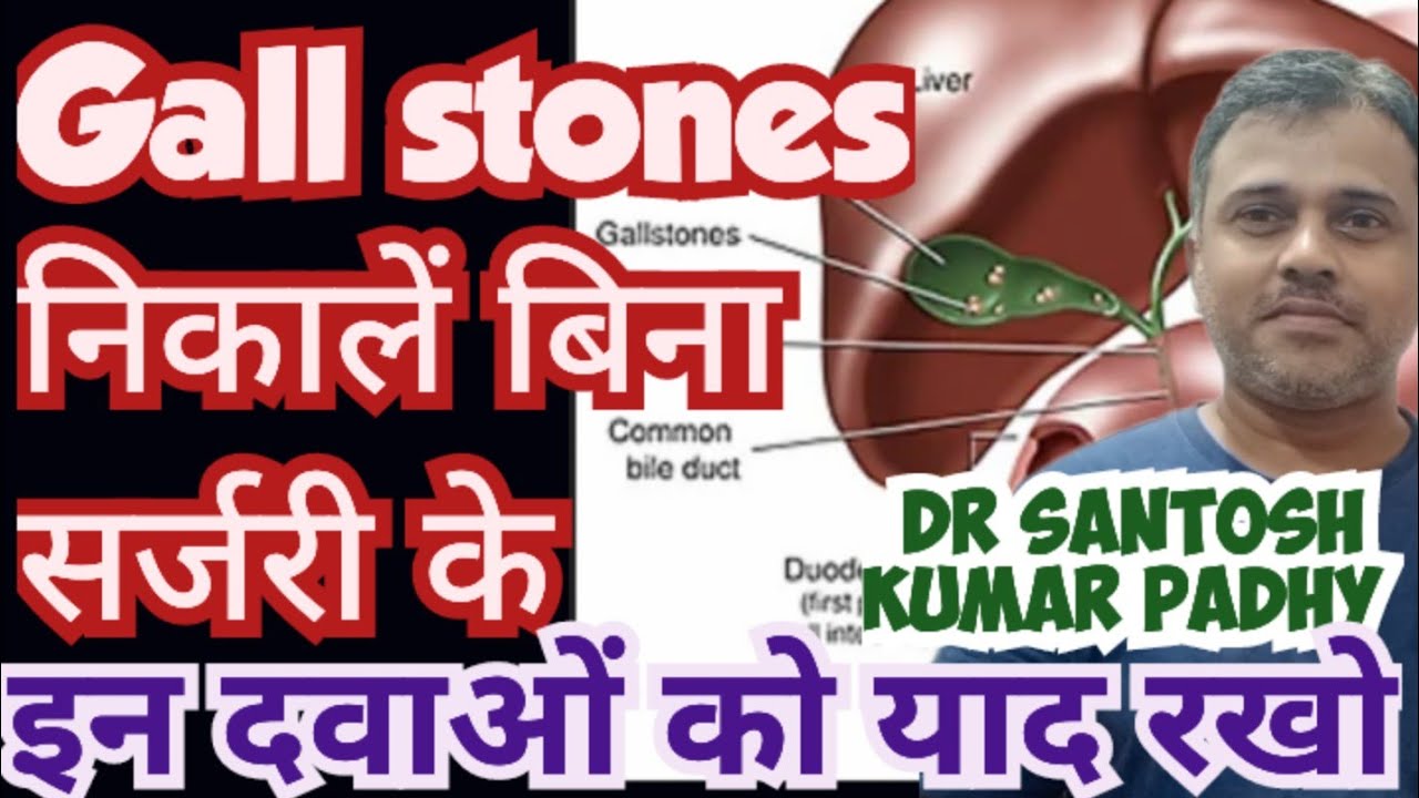 How to remove gall stones without surgery with homeopathic medicines ...