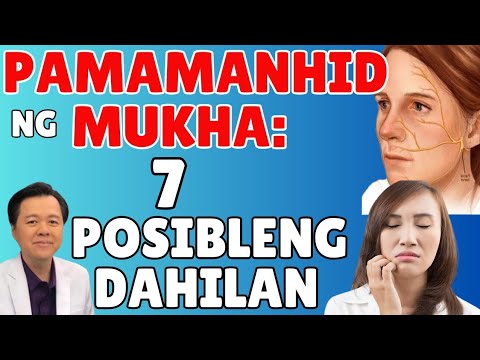 Pamamanhid ng Mukha: 7 Posibleng Dahilan. - By Doc Willie Ong (Internist and Cardiologist)