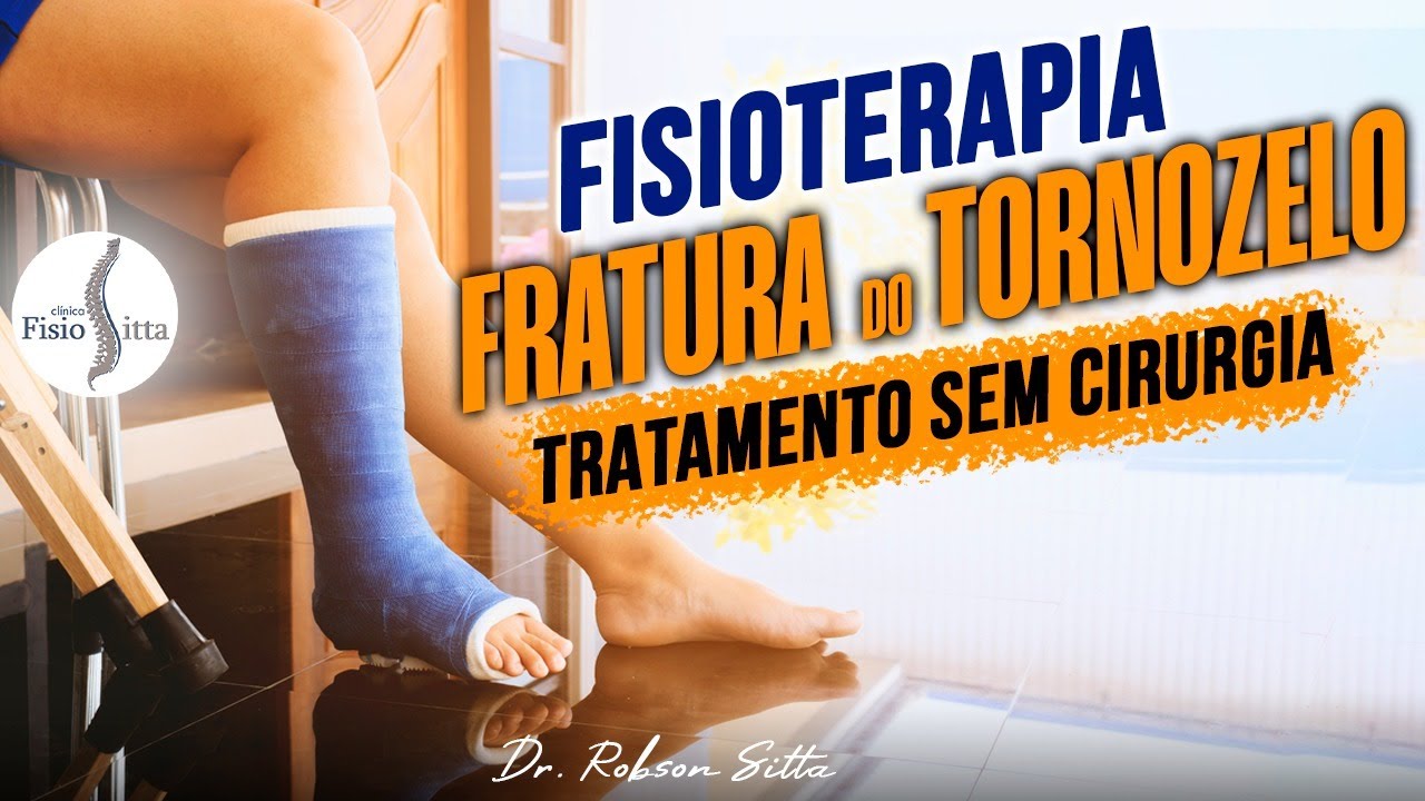TORNOZELO FRATURA do MALÉOLO LATERAL TRATAMENTO NÃO CIRÚRGICO Clínica ...