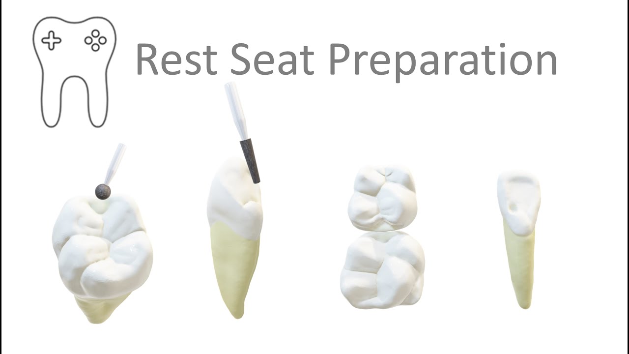 RPD Rest Seat Preparation Technique In 6 Mins YouTube rpd-rest-seat-preparation-technique-in-6-mins-youtube