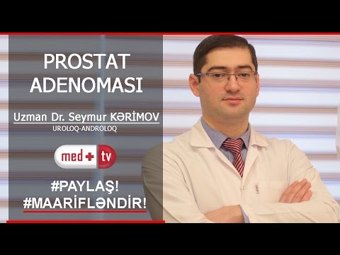 Prostat adenomasi - Uzman hekim Seymur Kerimov Uroloq-Androloq MEDPLUS