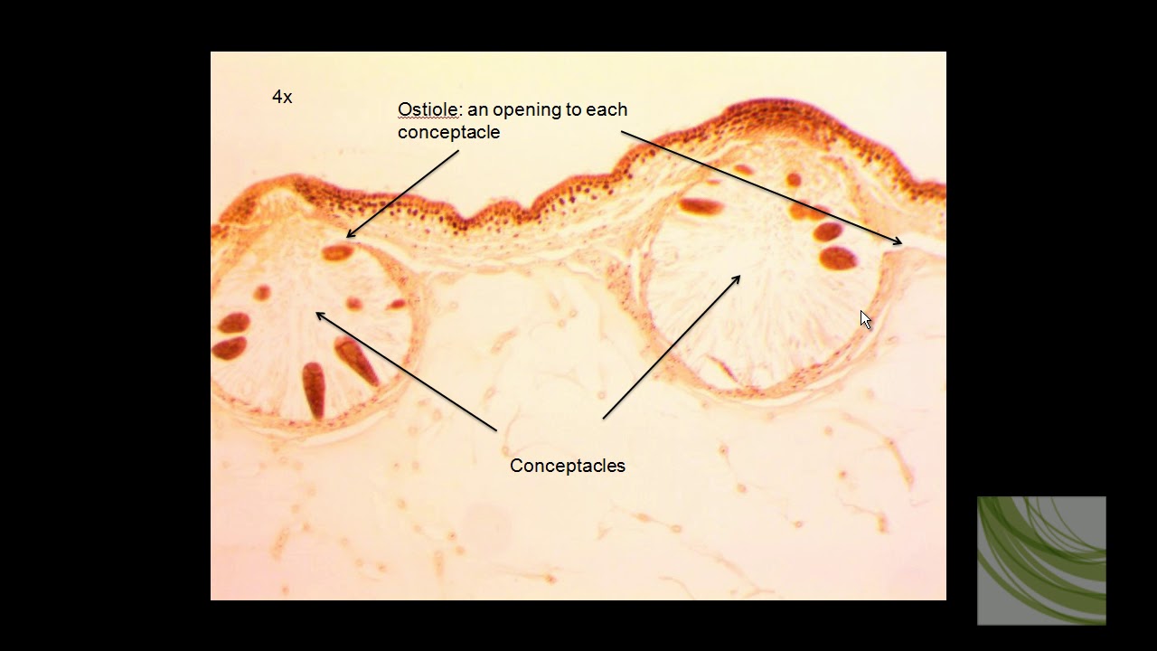 Fucus Slide Labeled