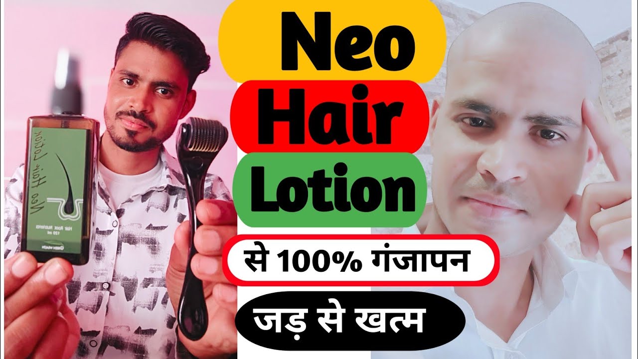How to Use neo hair lotion & derma roller for fast hair growth | Hair ...
