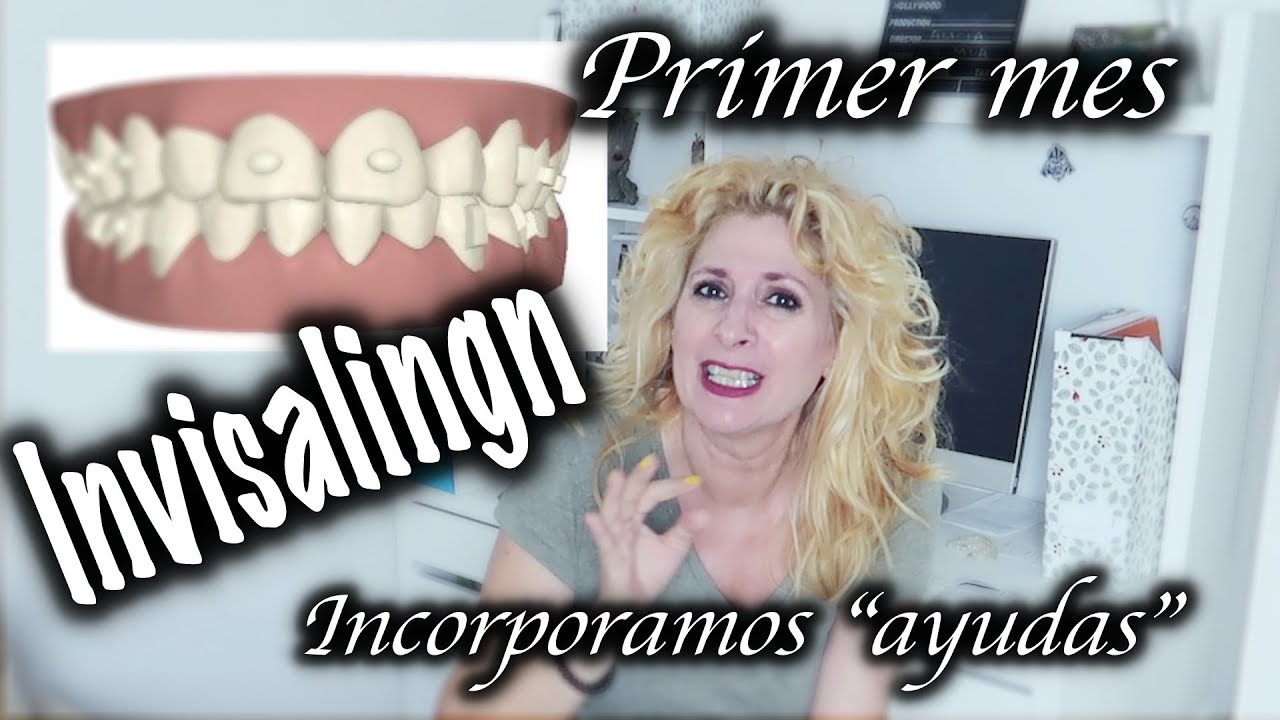 INVISALIGN mes 1 ATACHES Y BOTONES - YouTube