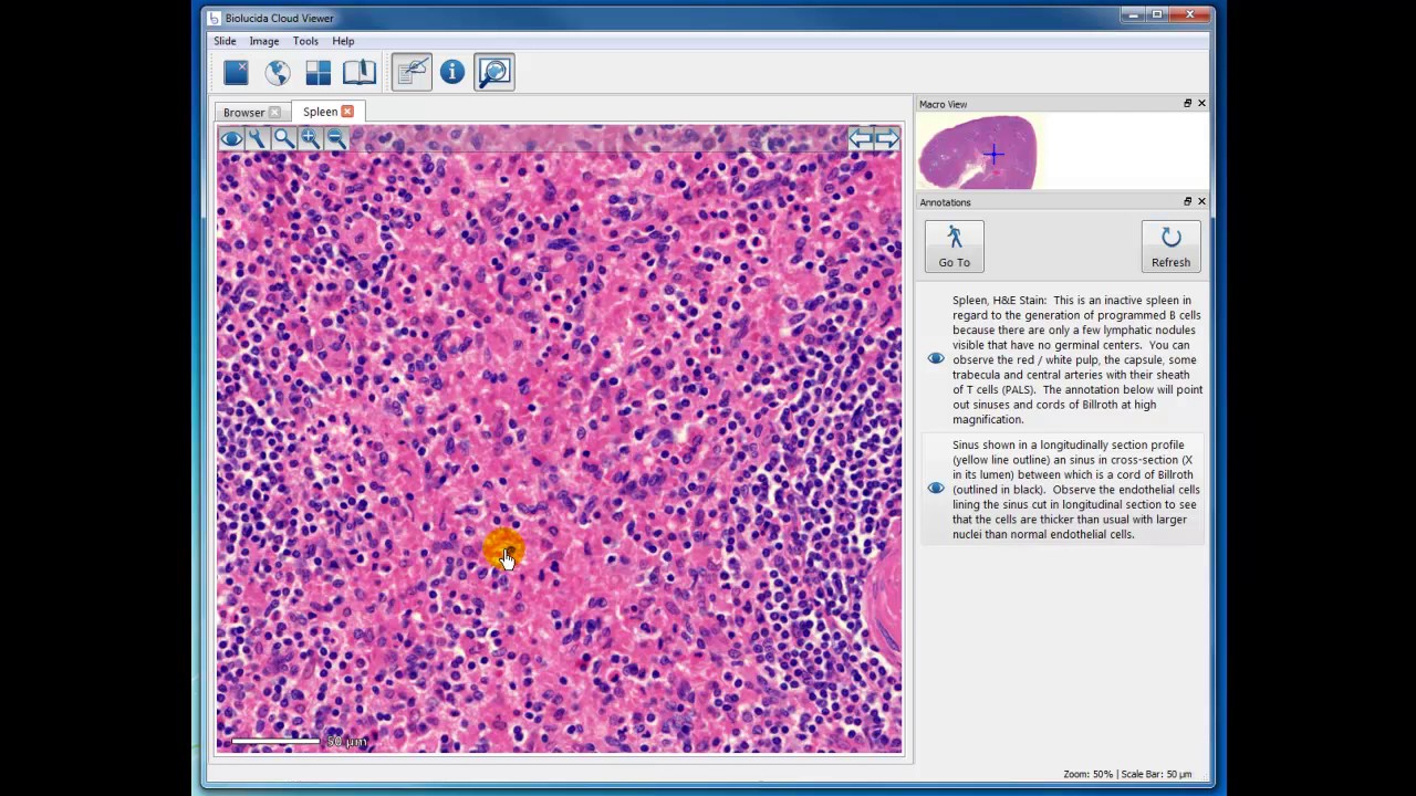 Module 3 Spleen - YouTube