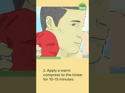 How to Get Rid of a Hickey  #shorts