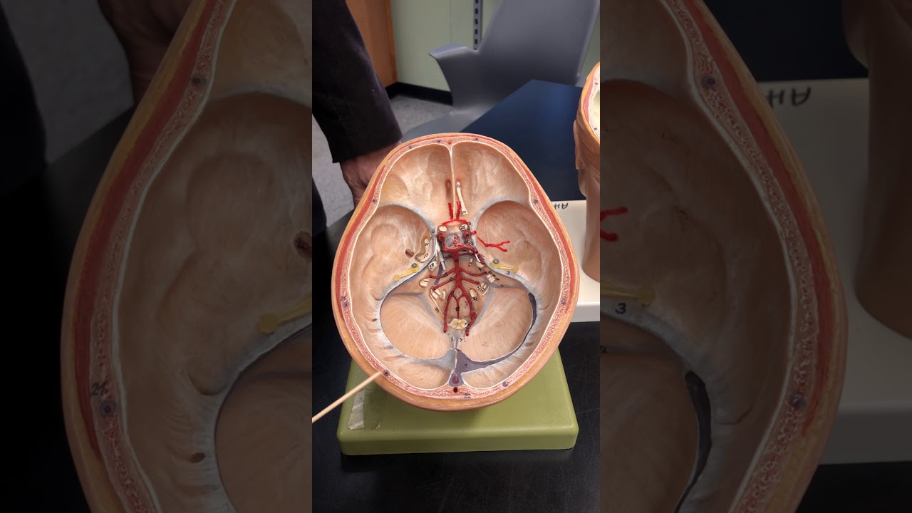 Arteries Inside the Cranium - YouTube