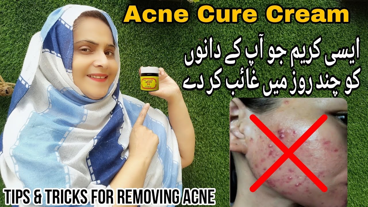 Get rid of acne and pimples || Tips for removing acne || Acne cure ...