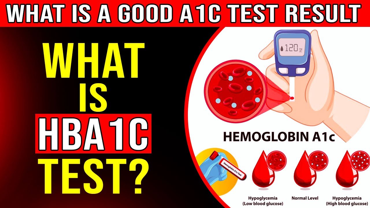 A1C Test for Diabetes Explained - What is a Good A1C Level? (HbA1c ...