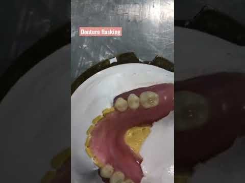 Denture flasking /denture processing/dental technology - YouTube