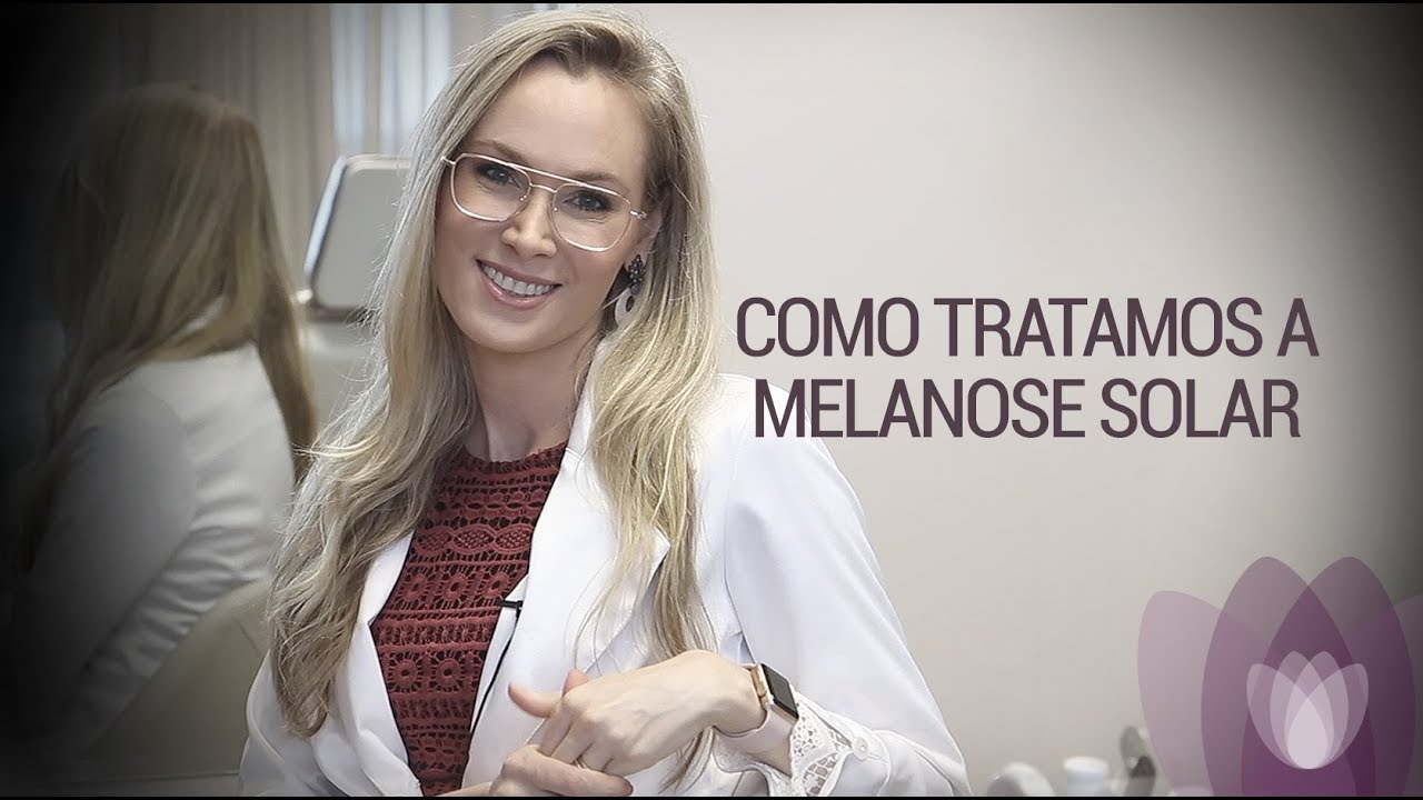 COMO TRATAMOS A MELANOSE SOLAR - Dr. Gabriela Schaefer - Dermatologista ...