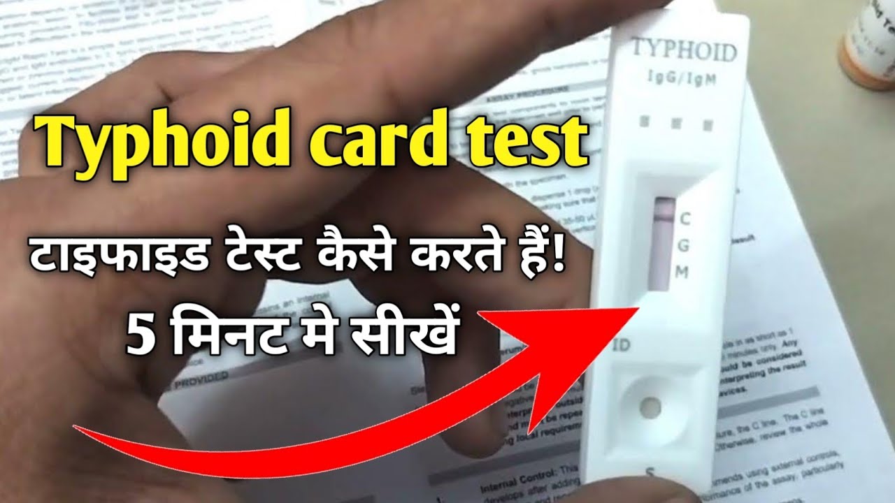 Typhoid test || typhoid kit test - YouTube