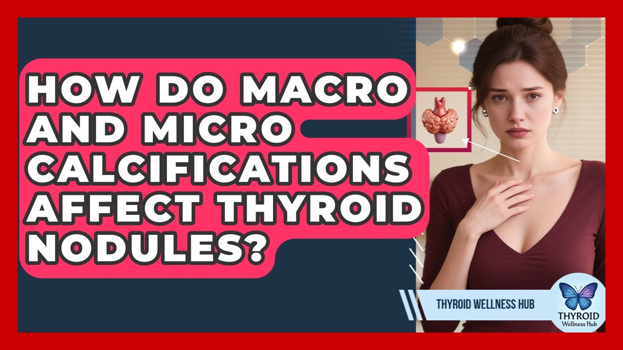 How Do Macro And Micro Calcifications Affect Thyroid Nodules? - Thyroid ...