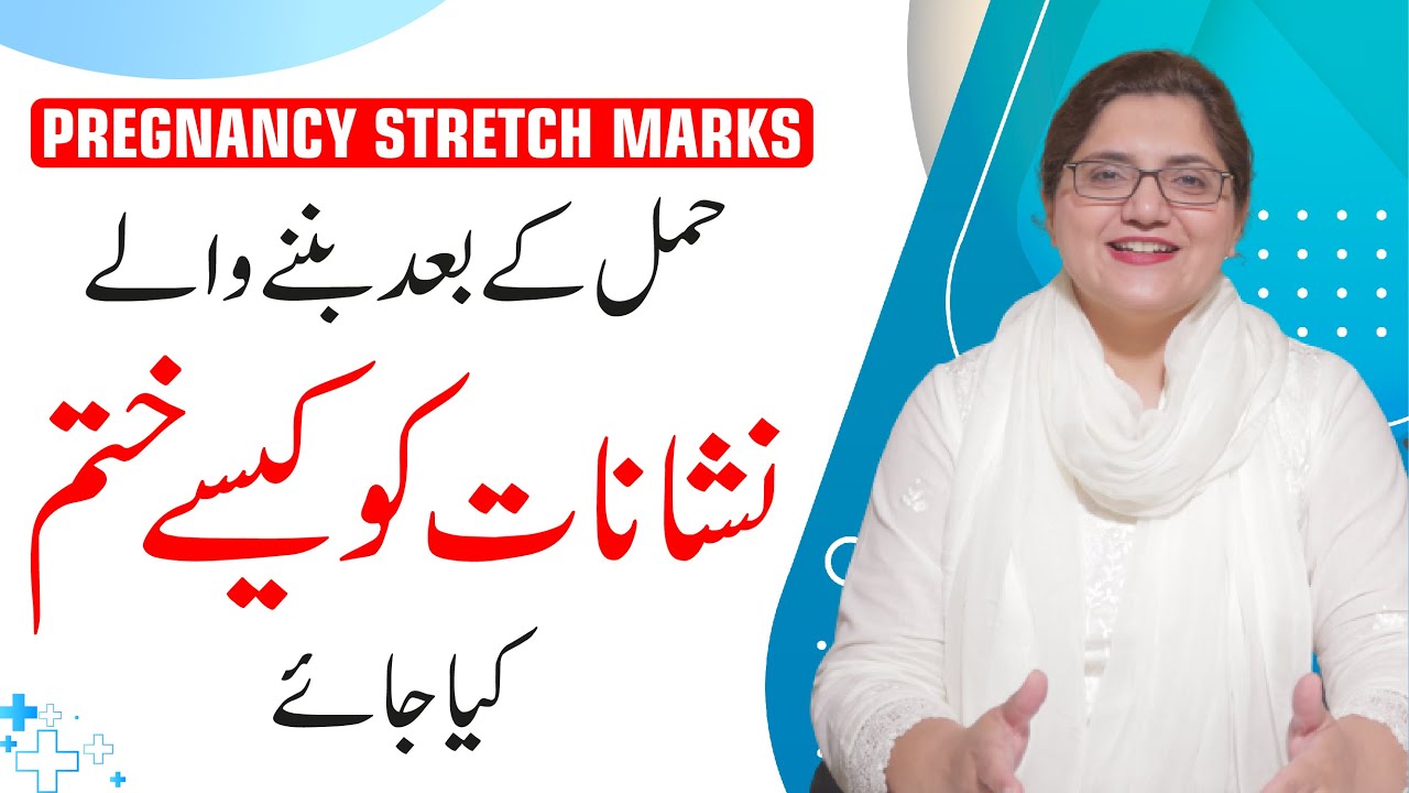 Pregnancy Stretch Marks - How to Remove or Reduce Stretch Marks - Dr ...