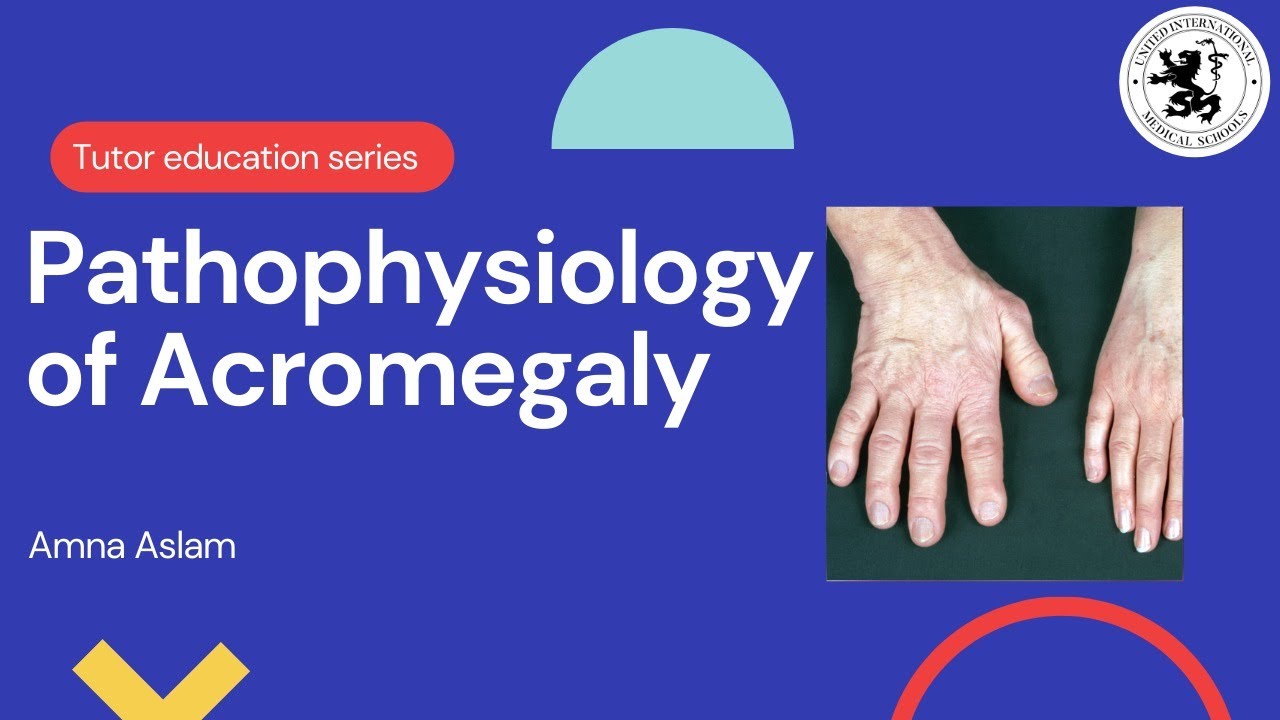 Pathophysiology of Acromegaly - YouTube