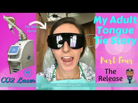 My Adult Tongue Tie RELEASE | Part 4