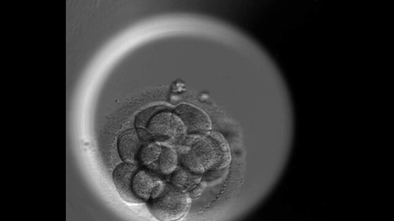 Embryoscope+: el proceso de la vida. - YouTube