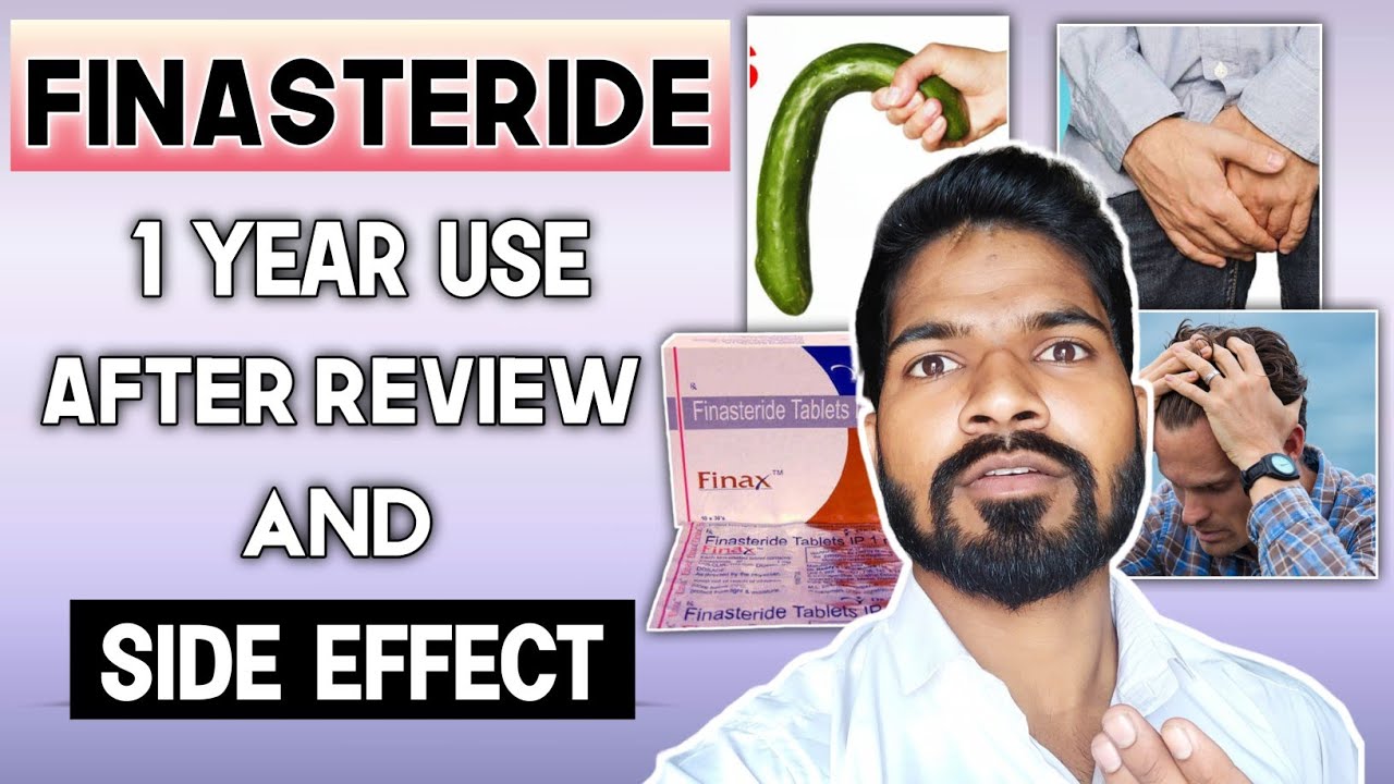 finasteride side effects | finasteride 1 year use after Review | लिंग ...