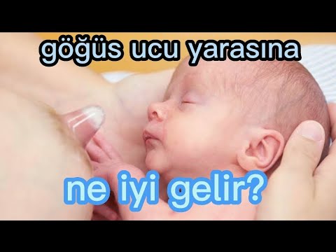 göğüs ucu yarasi neden oluşur? göğüs ucu yarasına ne iyi gelir?