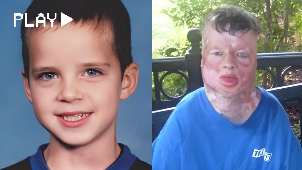 The horrific case of Robbie Middleton - YouTube